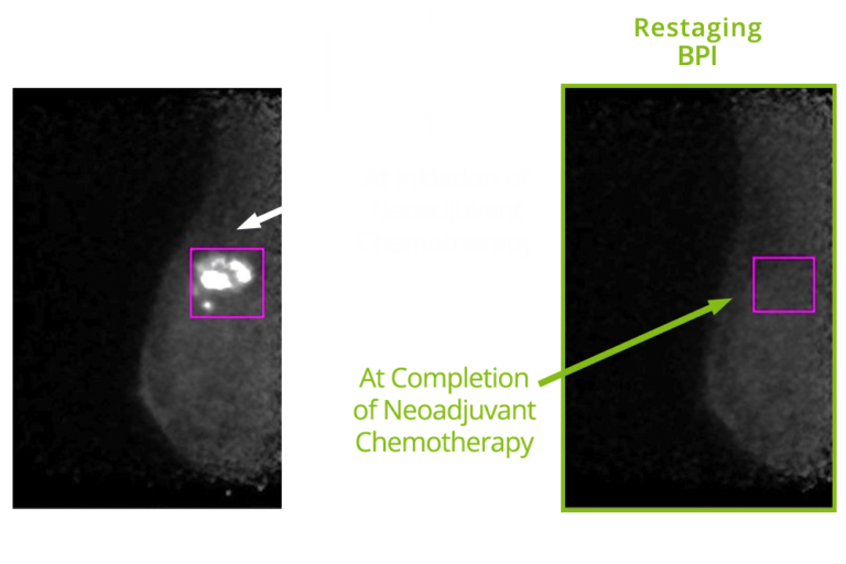 CMR Naviscan – Breast Cancer Imaging Solutions